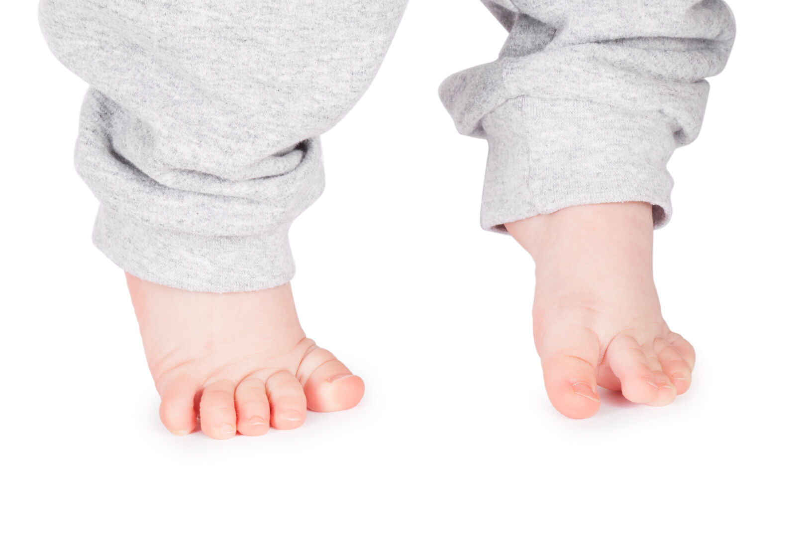 Fort Myers Physical Therapy Tips & Tricks to Prevent & Reduce Toe ...