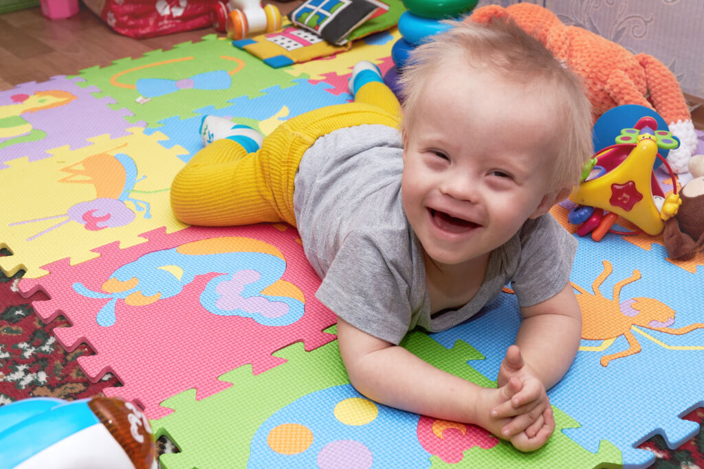 Physical Therapy Exercises For Babies With Down Syndrome Focus Therapy physical-therapy-exercises-for-babies-with-down-syndrome-focus-therapy
